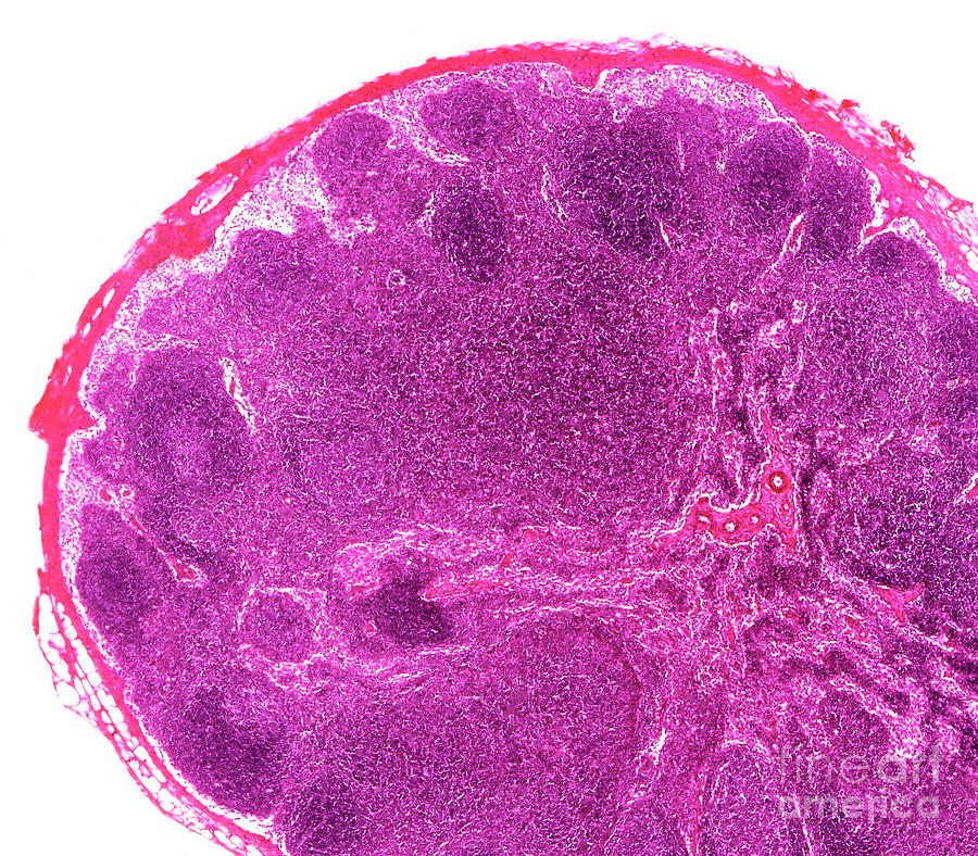 Rabbit Lymph Node Photograph by Nigel Downer / Science Photo Library ...